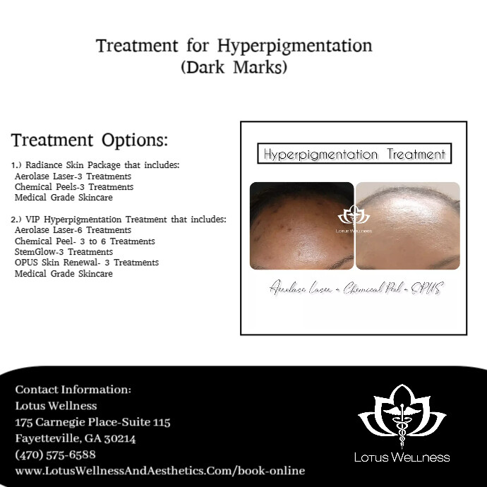 Copy of Hyperpigmenation Treatment | PosterMyWall