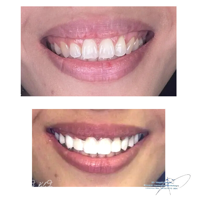 Before & After challenge flyer (13) | PosterMyWall