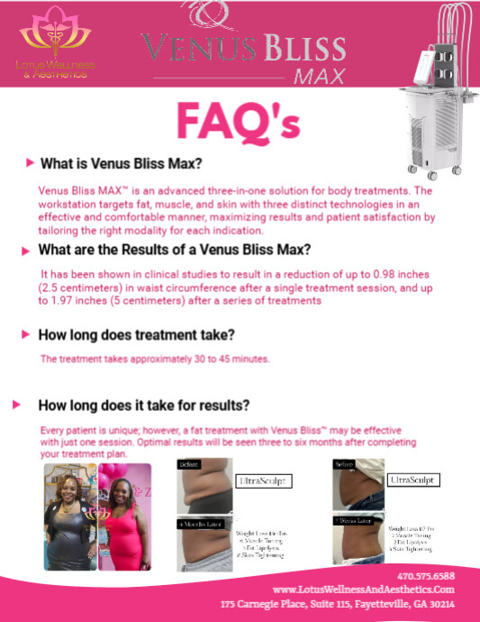 Venus Bliss Max FAQs | PosterMyWall