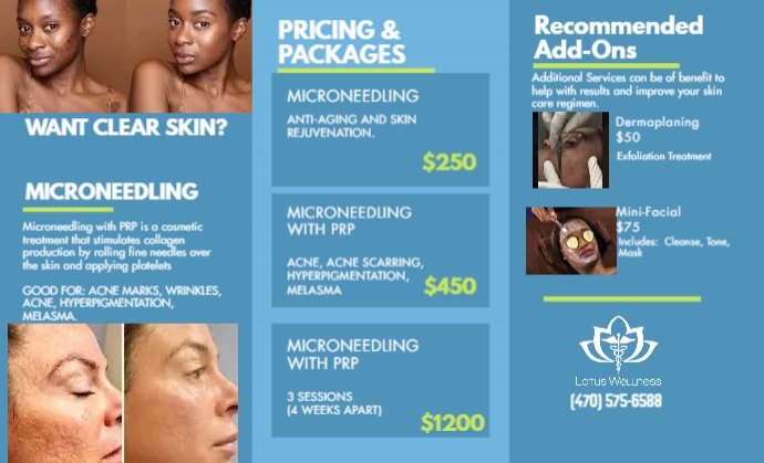 MICRONEEDLING | PosterMyWall