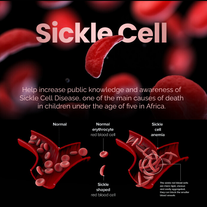 Black 3d World Sickle Cell Day Instagram Post Template | PosterMyWall