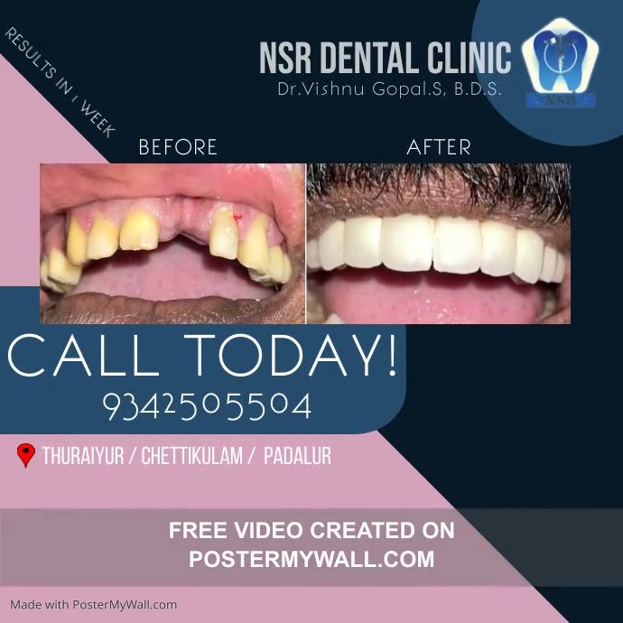 Dentist Before After Ad | PosterMyWall