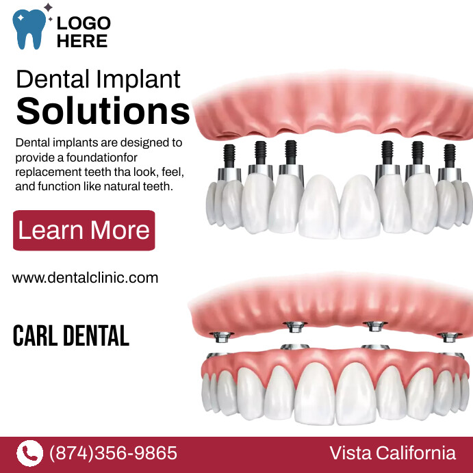 Dental Implant Solutions Template | PosterMyWall