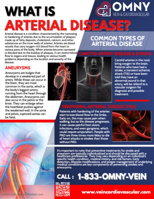 Arterial Disease | PosterMyWall