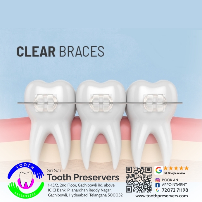 Root canal (1) Template | PosterMyWall