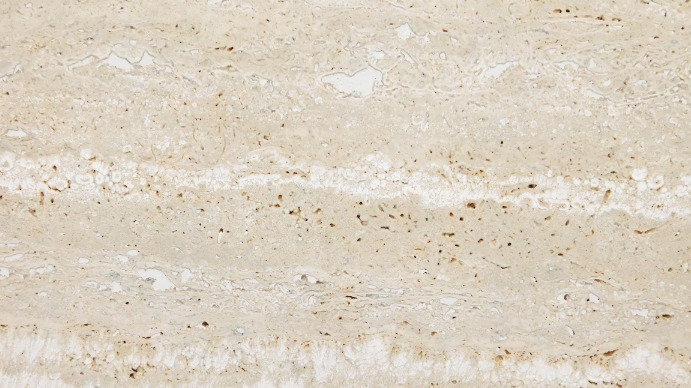 Stone texture Template | PosterMyWall