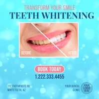 Teeth Whitening Instagram Post Template | PosterMyWall