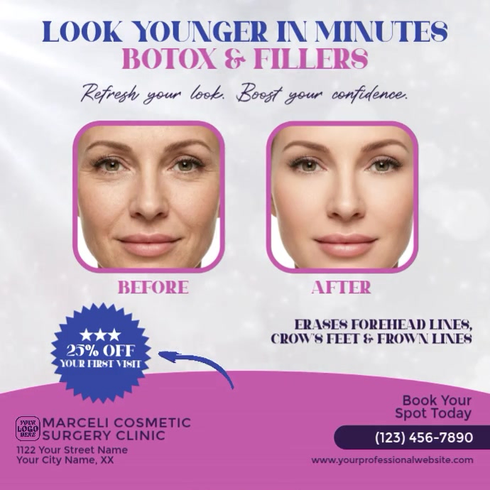 Plantilla de White Botox & Dermal Fillers Medical Spa Square Video ...