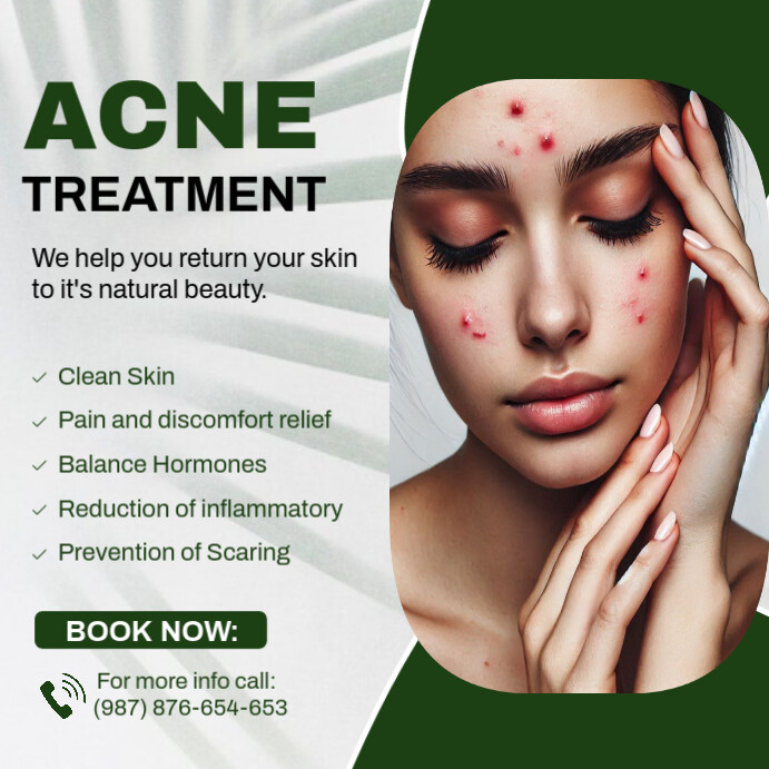 White Professional Acne Treatment Template Design Instagram Post ...
