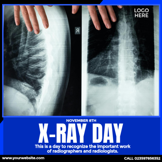 Copy of X-ray Day | PosterMyWall